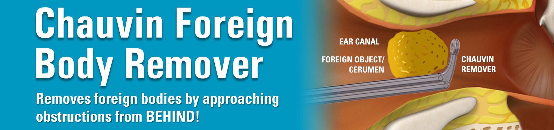 ENT Equipment - Medical Products - Surgical Instruments. Anthony Products